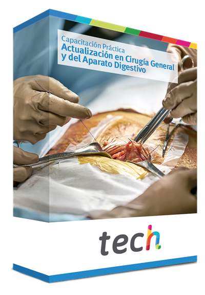 Capacitación Práctica en Actualización en Cirugía General y del Aparato Digestivo - TECH España