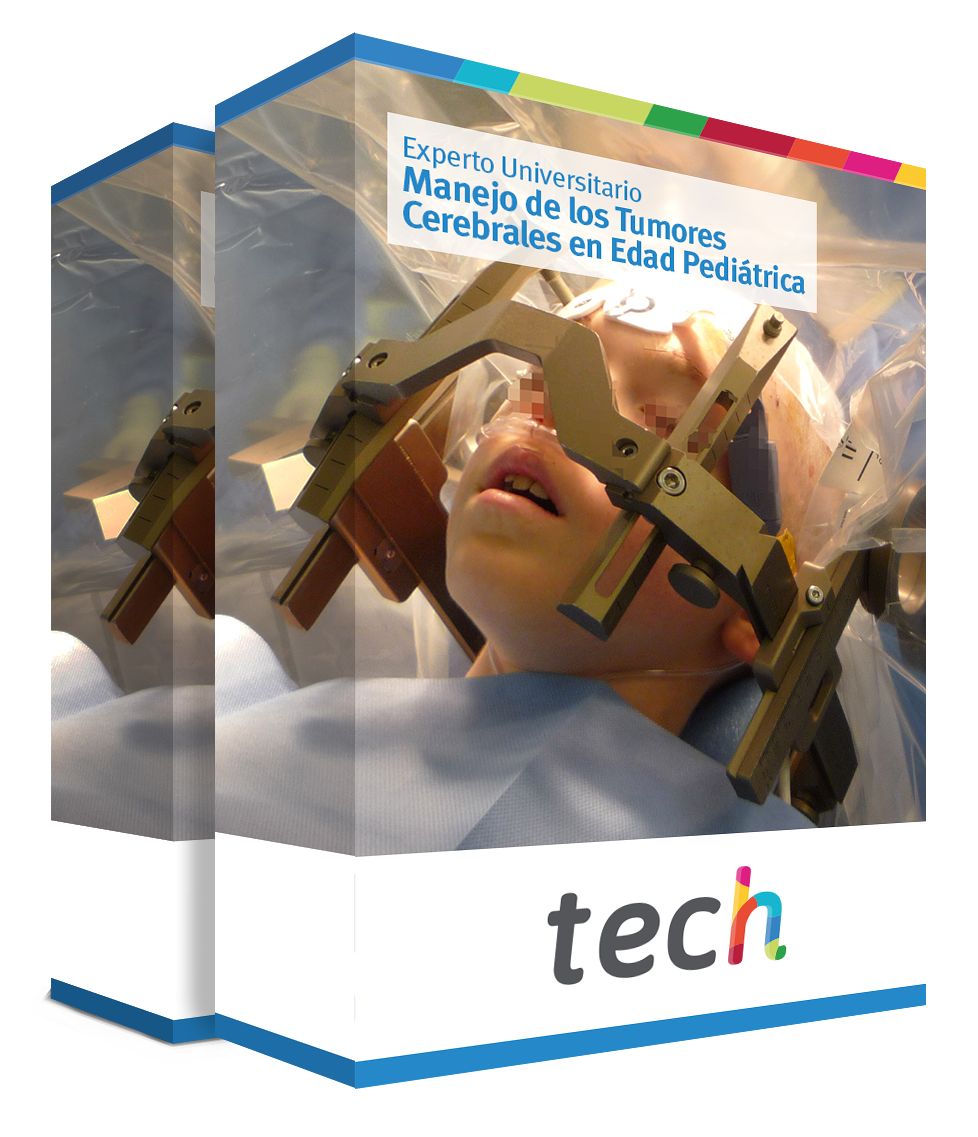 Especialización en Manejo de los Tumores Cerebrales en Edad Pediátrica - TECH Costa Rica